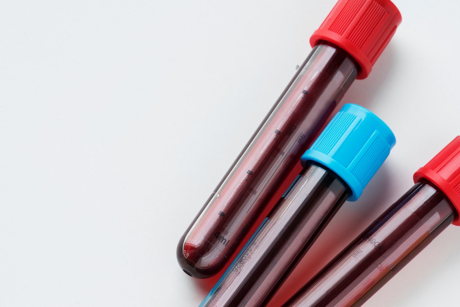 Which Blood Tests Are the Best? Are They Useful for Longevity?
